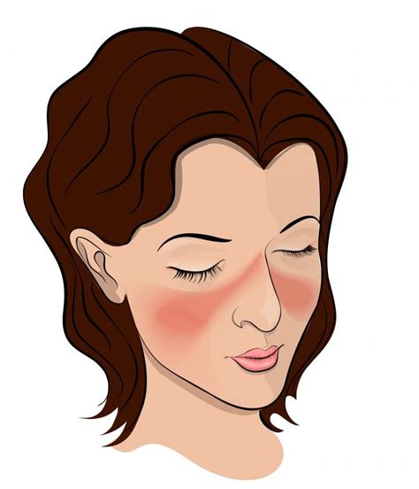 Systemic Lupus Erythematosus Umbrella Scientific