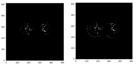 Introduction To Medical Image Processing With Python Ct Lung And