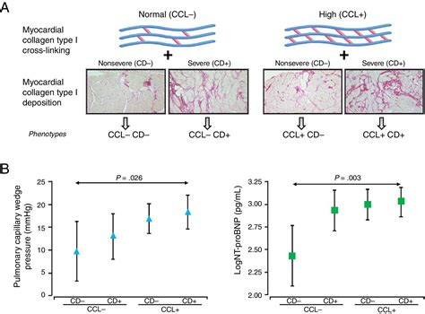 Myocardial Interstitial Fibrosis In The Era Of Precision Medicine Biomarker Based Phenotyping