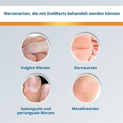 Endwarts Classic Solution 3 Ml Uk