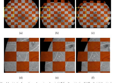 Figure 1 From Self Supervised Multimodal Reconstruction Of Retinal Images Over Paired Datasets