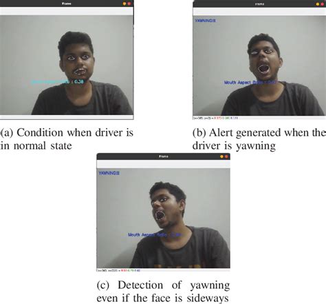 Figure 2 From System For Detecting Drowsiness In Drivers Semantic Scholar