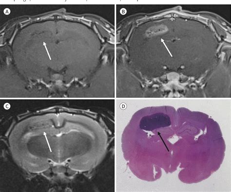 Figure 3 From Neuroradiology 연구를 위한 Vx2 세포를 이용한 토끼 뇌종양 모델 제작과 Mri를 이용한