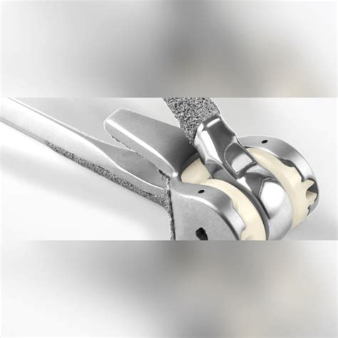 Durable Cemented Elbow Prosthesis Sale Or Rent Near Me Goldstar