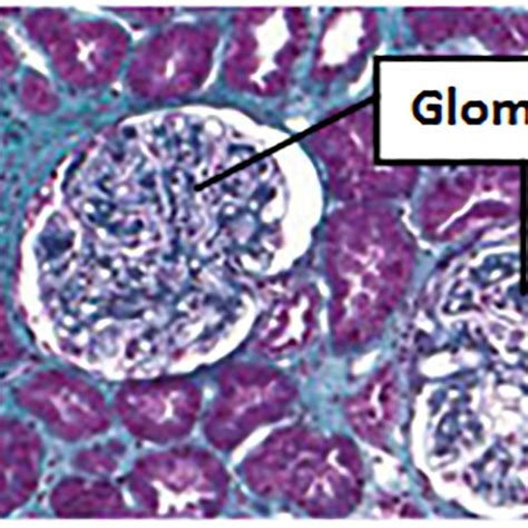 A Renal Biopsy Image With Two Glomeruli In The Glomdb Set [12] The