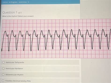 Question 1 Of 5 What Is The Rhythm Select StudyX