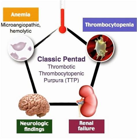 Classic Pentad Ppt Medizzy
