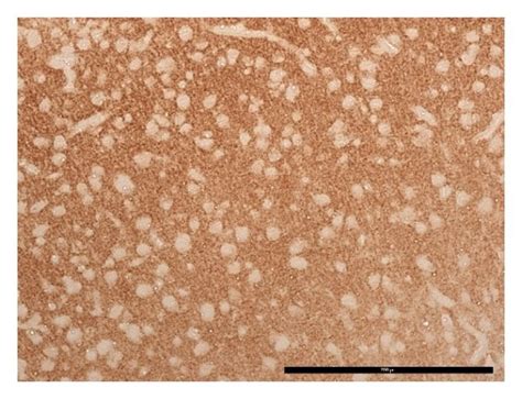 Photographs Of Synaptophysin Immunoreactivity In The Motor Cortex
