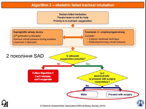 Складні дихальні шляхи в акушерстві Особливості і нові рекомендації