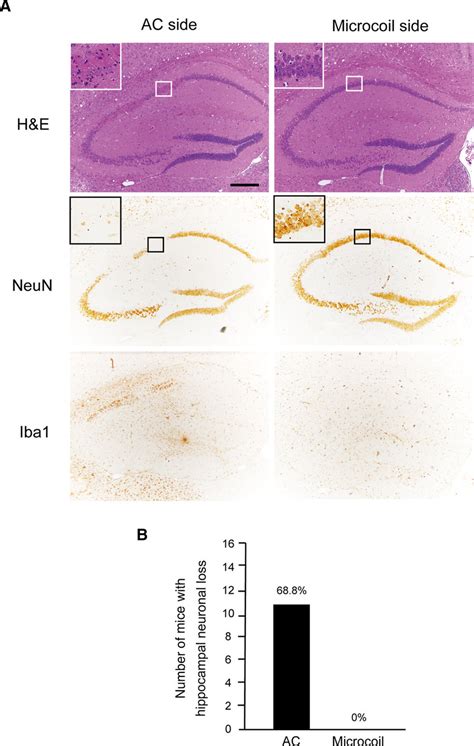 Hippocampal Neuronal Loss Was Seen Only At The Ac Side Of Acas Mice A Download Scientific