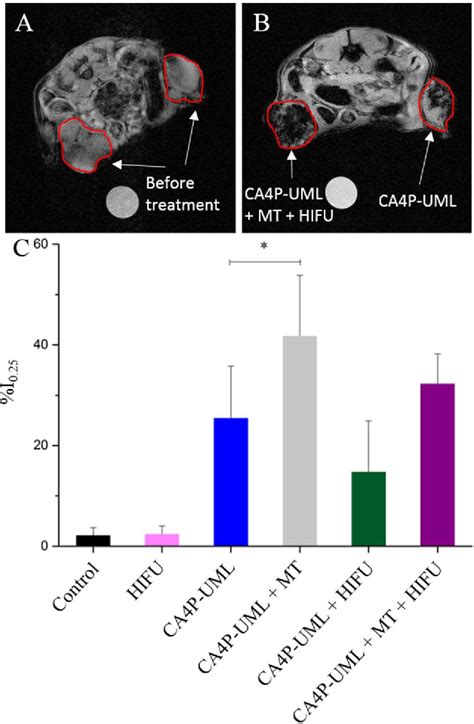Figure 5 From Theranostic Mri Liposomes For Magnetic Targeting And