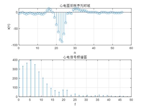 Iir数字滤波器的设计及应用——matlabiir数字滤波器设计 Csdn博客