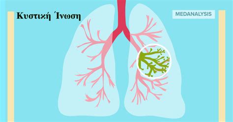 Κυστική Ίνωση Προγεννητικός Έλεγχος Δημήτριος Μπούρας