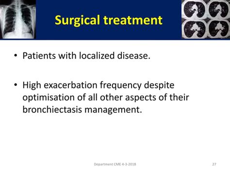 Bronchiectasis 2018 Ppt