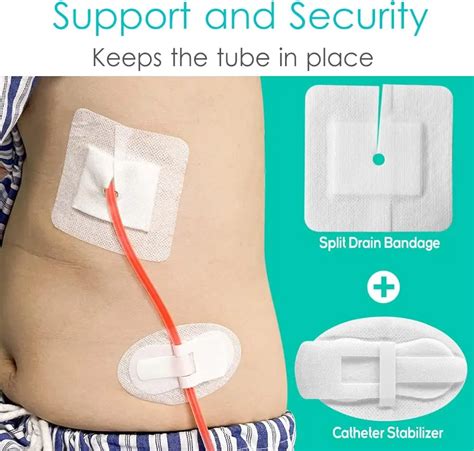 Catheter Fixation Dressing Peritoneal Dialysis Pd Catheter Bordered Gauze Abdominal Pad Drain