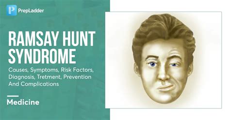 Ramsay Hunt Syndrome Causes Symptoms Diagnosis And Prevention