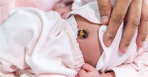 មើលថែទាំស្បែកទារក តាមវិធីសាស្រ្តងាយៗ មាតា