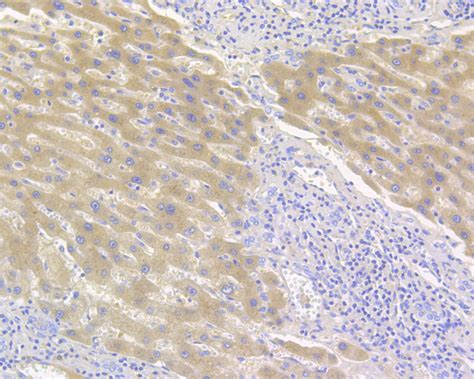 Complement Factor B Rabbit Polyclonal Antibody Ha500036 Huabio