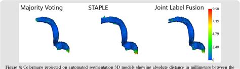 Figure 1 From Automated Segmentation Of The Sigmoid Sinus Using A Multi