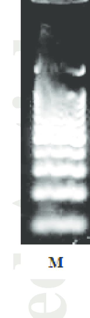 An Agarose Gel Electrophoresis Showing The Pcr Products Of Sry Gene