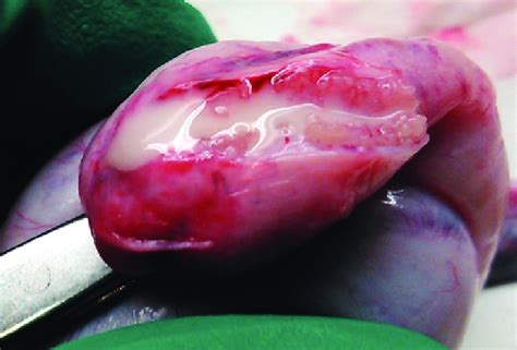 Figuur 3 Incisie In De Cauda Epididymidis Geïndividua Liseerd Door Download Scientific