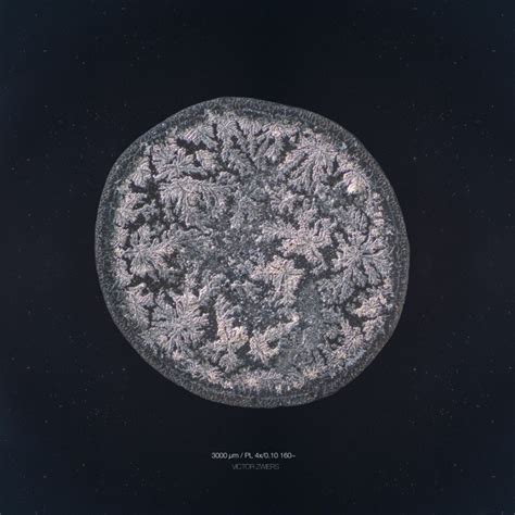 Human Tears Viewed Under A Microscope Boing Boing