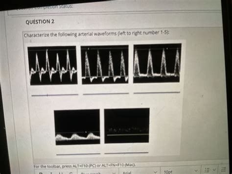 Week 1 Quizzes Flashcards Quizlet Week 1 Quizzes Flashcards Quizlet