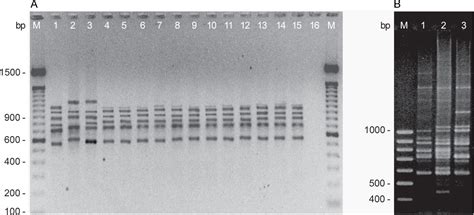 Figure 1 From Application Of Pcr Ribotyping And Tdna Pcr For Klebsiella