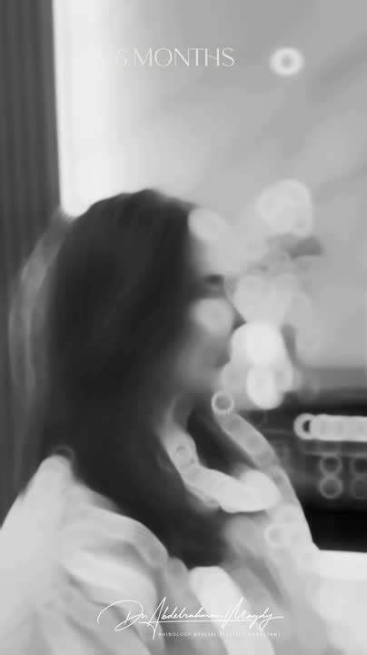 Abdelrahman Hussein On Linkedin 6 Months Results After Aesthetic Rhinoplasty And Tip Definiton