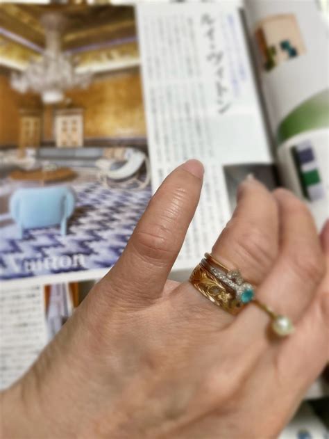 指の捻挫と変形 痛みの原因は女性ホルモンの低下だった？！ 天然石リーヴァマーレ店主 アラカンマムの日々つれづれ