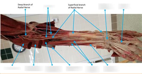 Forearm Anatomy Cadaver At Sam Hernsheim Blog