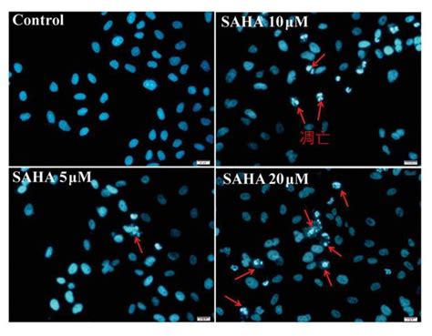 细胞凋亡检测方法——无废话实用指南 知乎