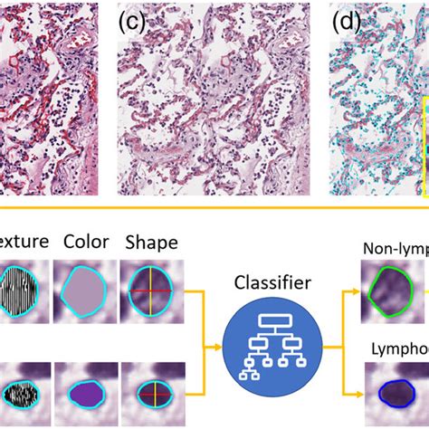 Procedure For Automatic Detection Of Lymphocytes Top Row A A Wsi Download Scientific