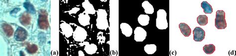 Sub Processes Of Segmentation Stage A Cropped Part Of An Original Download Scientific