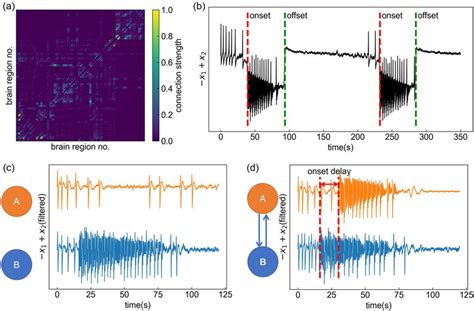 Construction Of The Whole Brain Model For Seizure Onset And Spread A