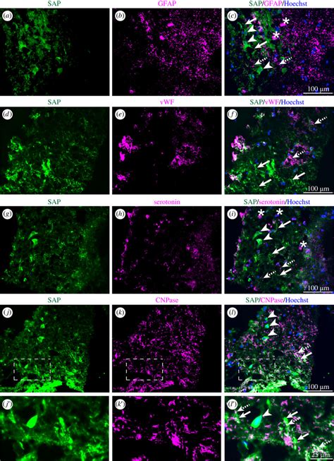 Axonal Deposition Of Sap In Contused Brain Tissue After Tbi Double Download Scientific Diagram