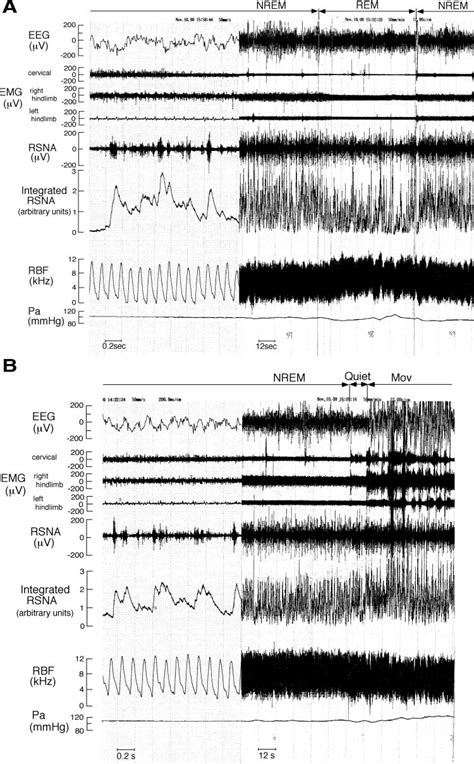 A Typical Recording From An Individual Rat Of Electroencephalogram Download Scientific Diagram