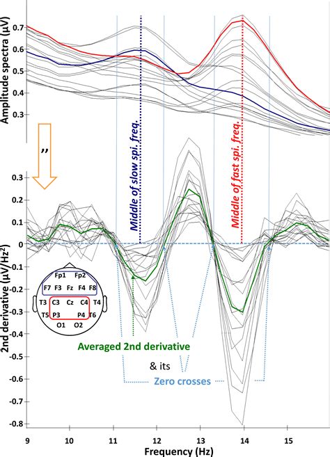 Sleep Spindle Eeg Frequency