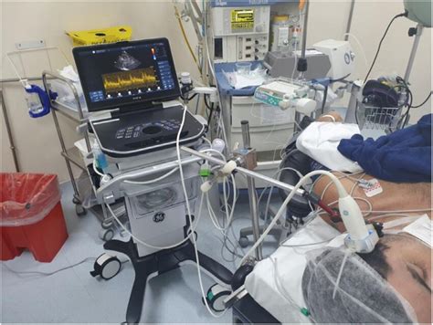 Use Of The Device For Transcranial Doppler Through The Temporal Window Download Scientific