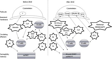Figure 1 From Update On The Treatment Of Focal Segmental Glomerulosclerosis In Renal