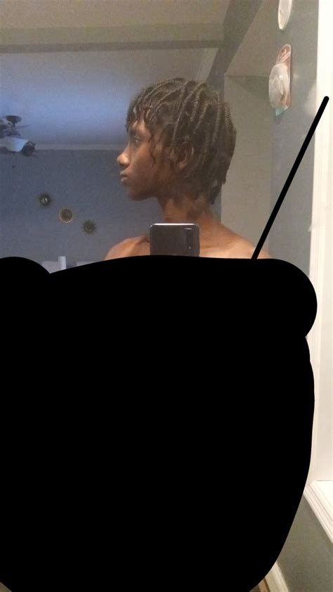 Am I Recessed How Recessed Am I R Mewing