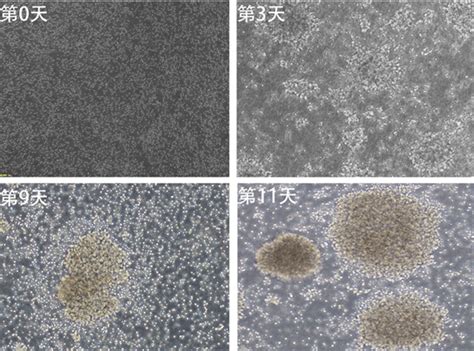 一种体外扩增nk细胞的新方法