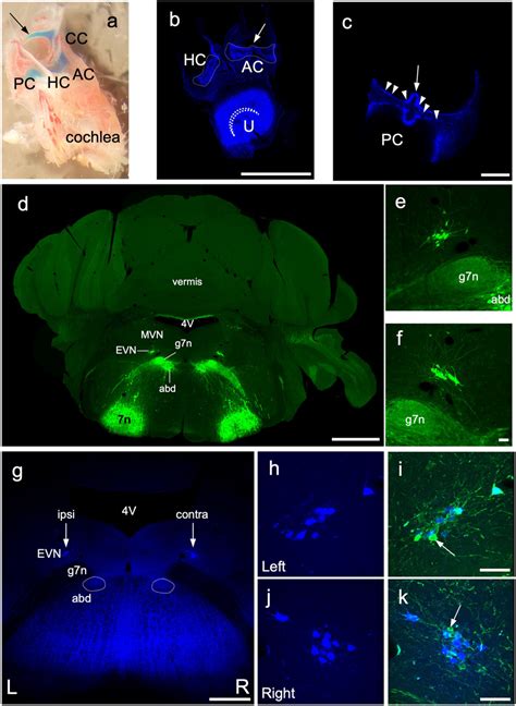 Retrograde Labeling Of Central Evn Neurons Fluoro Gold Fluorescent Download Scientific Diagram