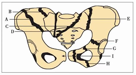 骨科医生必会的骨盆骨折8大分型，你真的都掌握了吗？ 上海开为医药科技有限公司 创伤、肢体矫形技术解决方案的专业服务商
