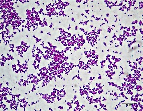 Gram Stain Staphylococcus Aureus