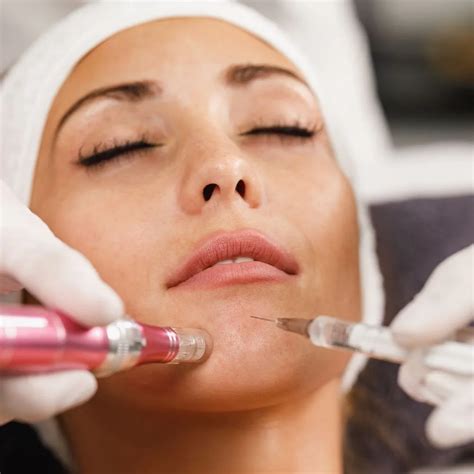 Mesotherapy Vs Microneedling Skin Rejuvenation Showdown