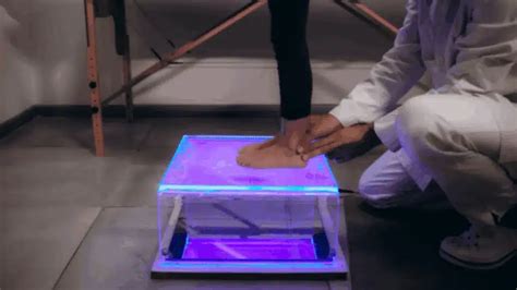 Ai Powered Gait Analysis In Healthcare