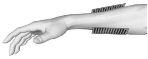 The Placement Of The High Density Emg Sensors In The Finger Movement
