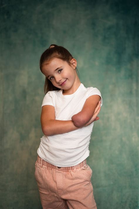 Ruby E Zbd Talent Models With Disabilities Visible Differences And Trans And Non Binary