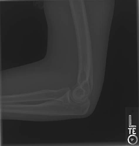 Xray Object Detection Dataset And Pre Trained Model By Xray